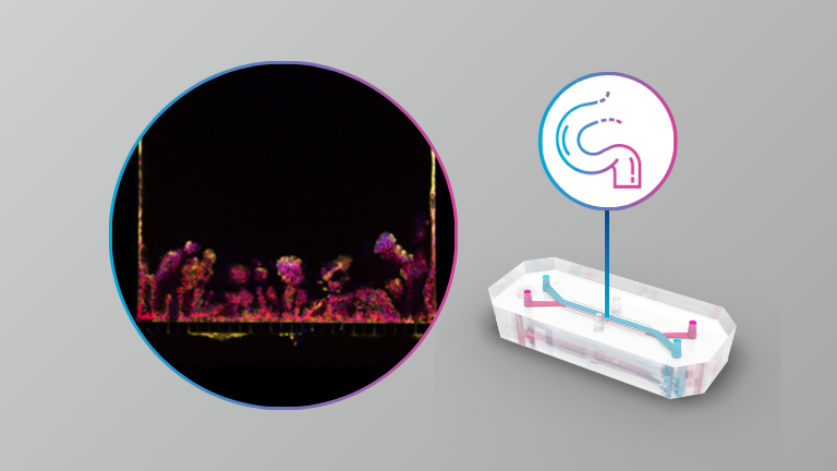 Gene expression profiling reveals enhanced nutrient and drug metabolism ...