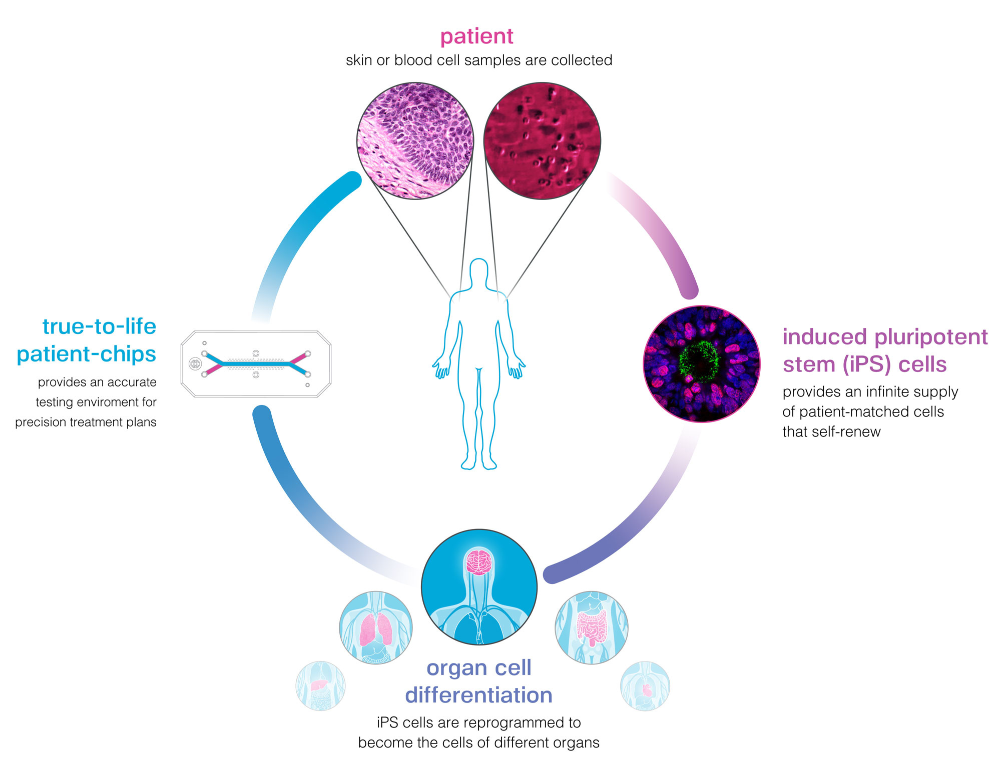 Advancing Precision Medicine with Patient-on-a-Chip Technology ...
