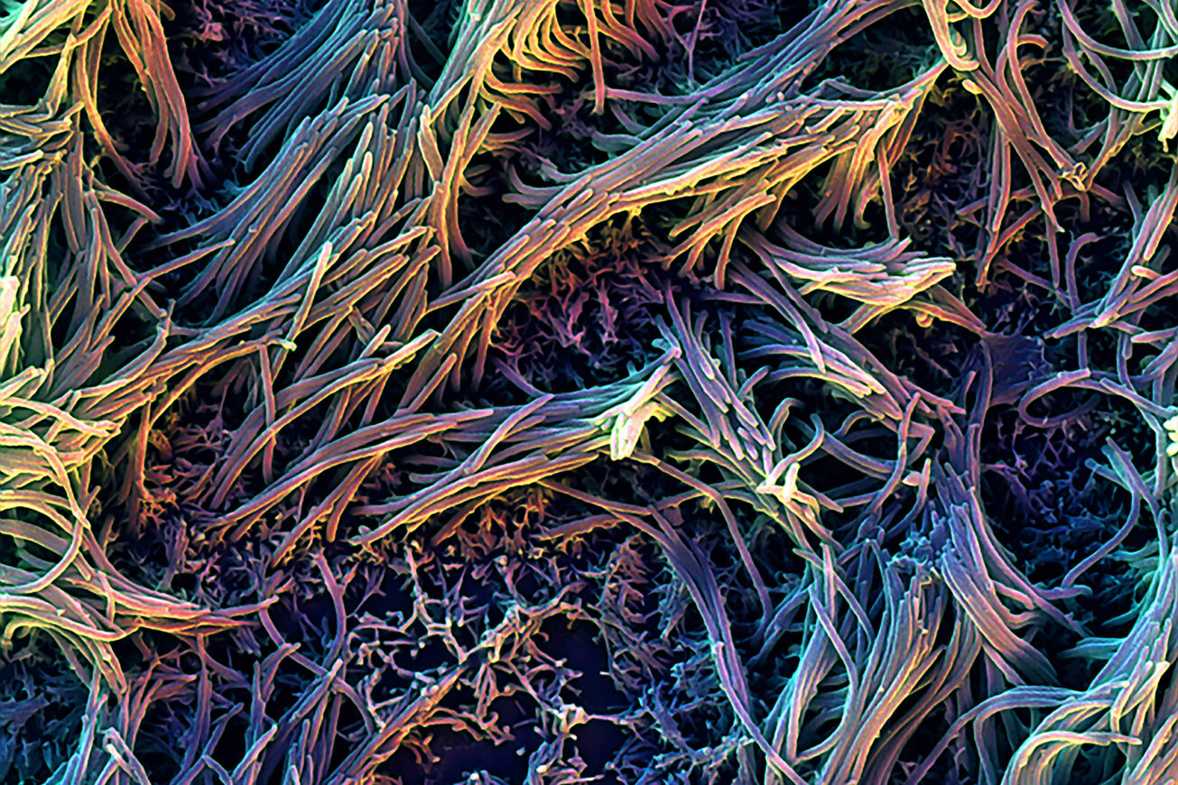 Organ-Chips: A Promising Model for Human Emulation | Emulate Blog