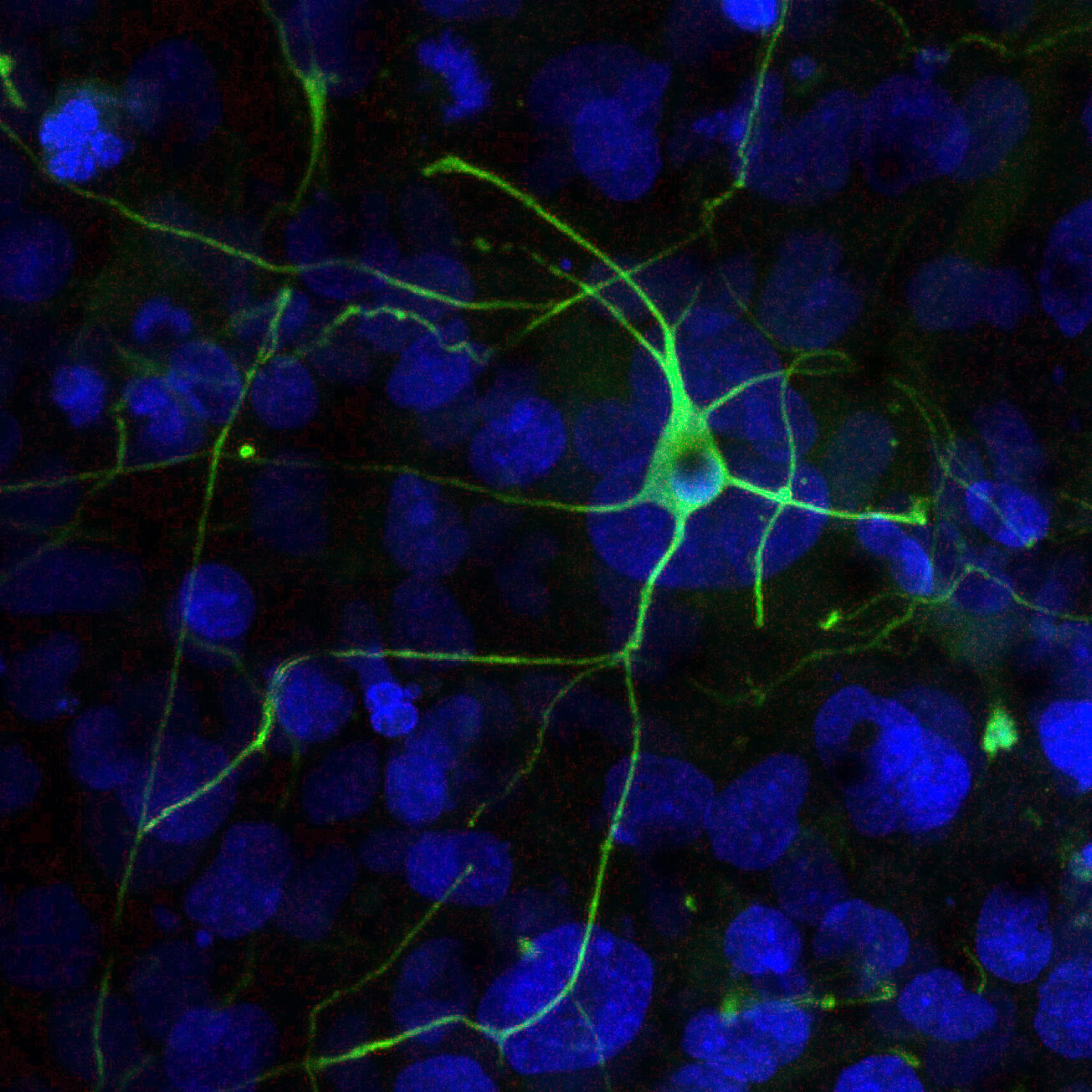 Emulate human Brain-Chip