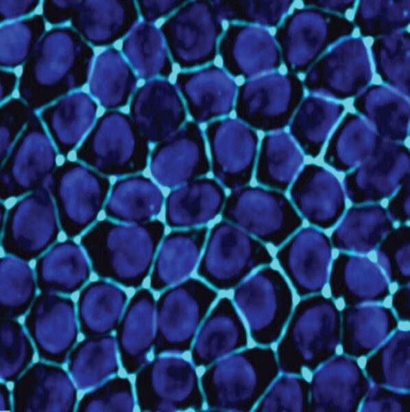 Emulate human Kidney-Chip