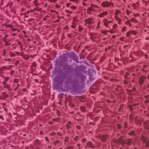 Emulate human Colon Intestine-Chip