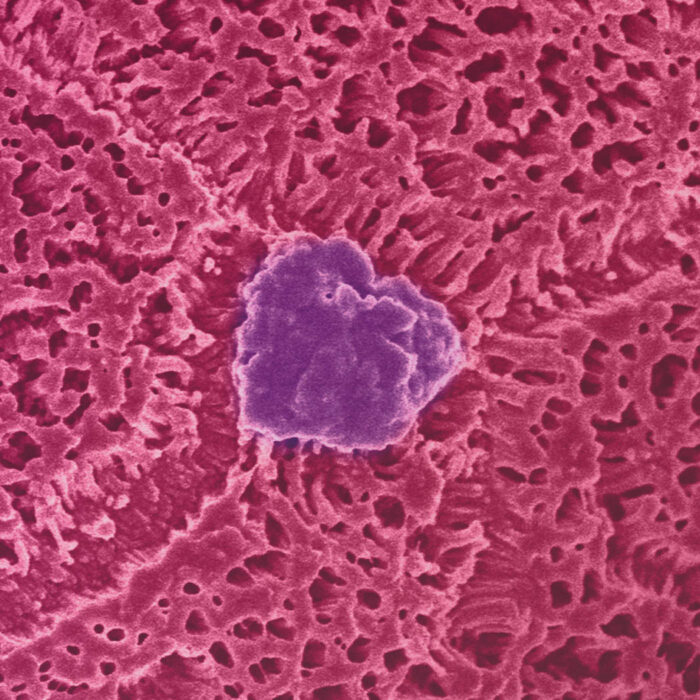 Emulate human Colon Intestine-Chip