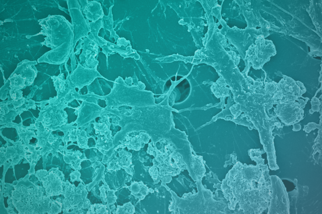 Investigating Parkinson's with Organ-Chips | Emulate Blog