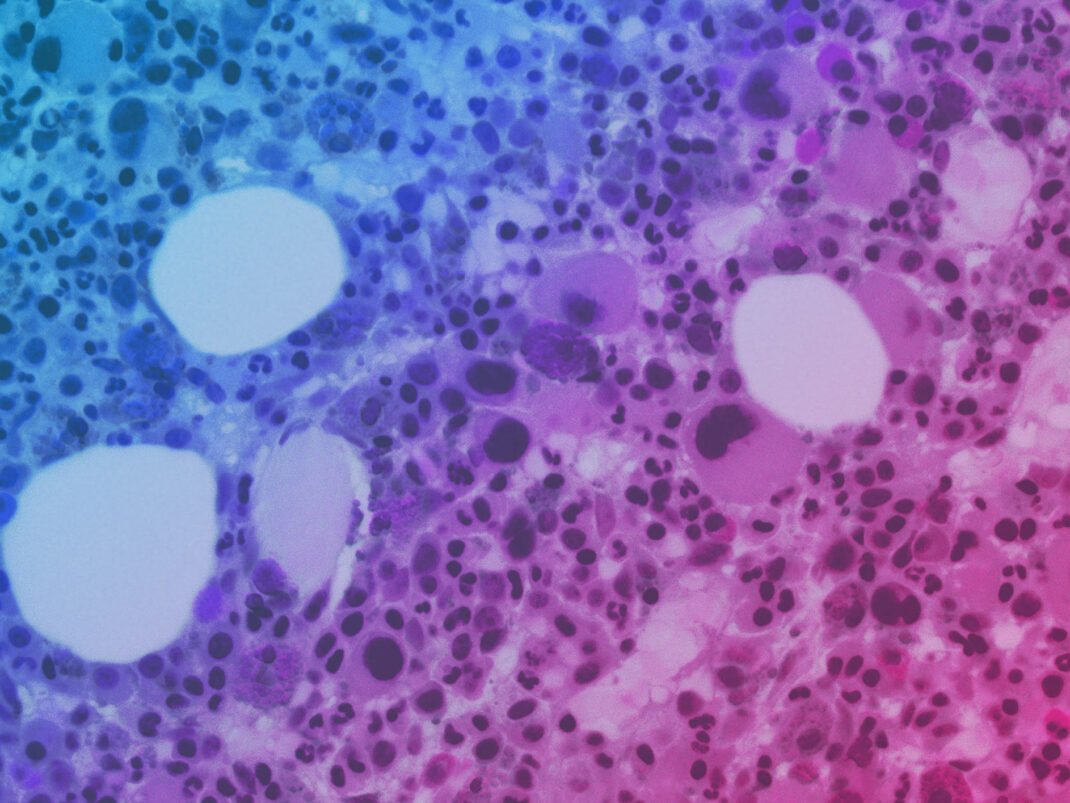 Creating an Organ-Chip Model of Bone Marrow | Emulate Blog