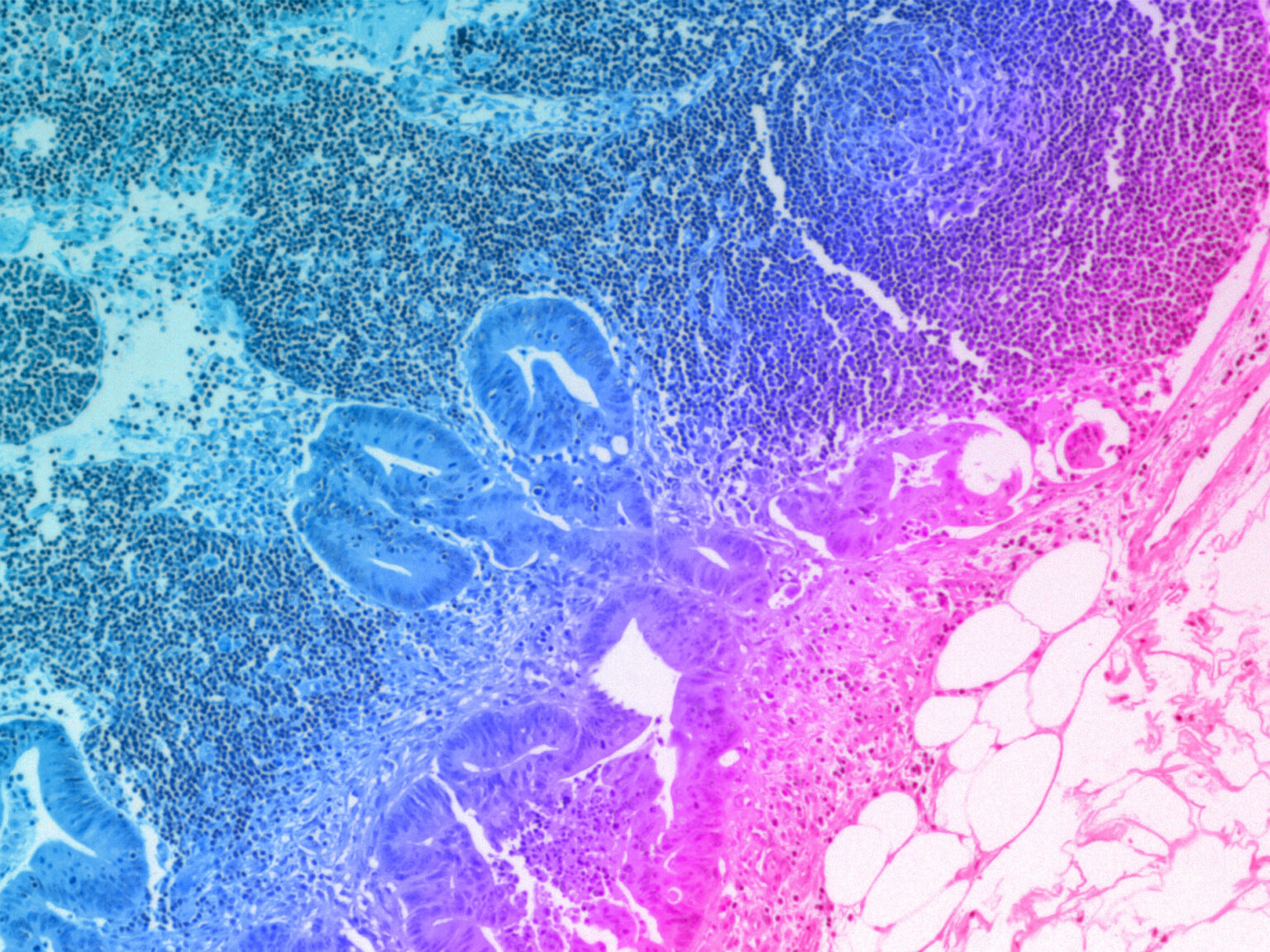 Emulate Chip-S1 Stretchable Chip