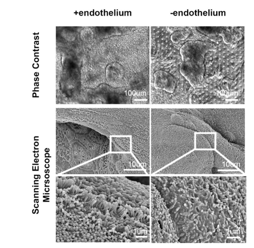 Organ-Chips and Organoids: Better Together | Emulate Blog