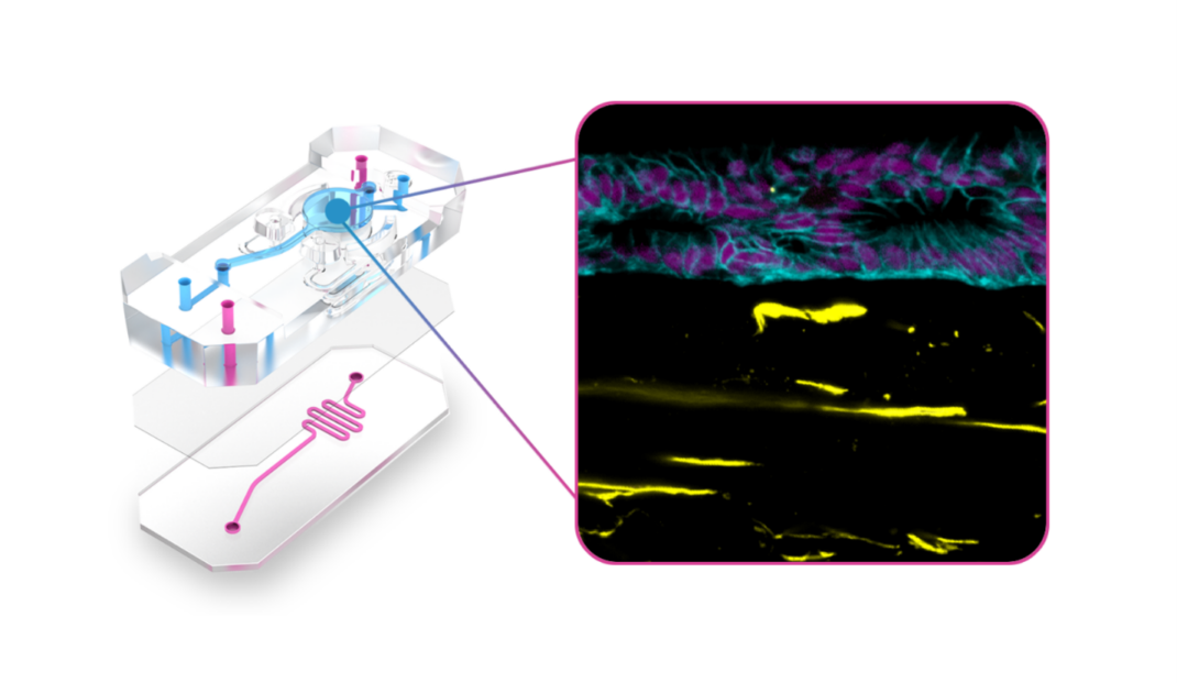 Unraveling the Complexities of Cancer Through More Human-Relevant ...