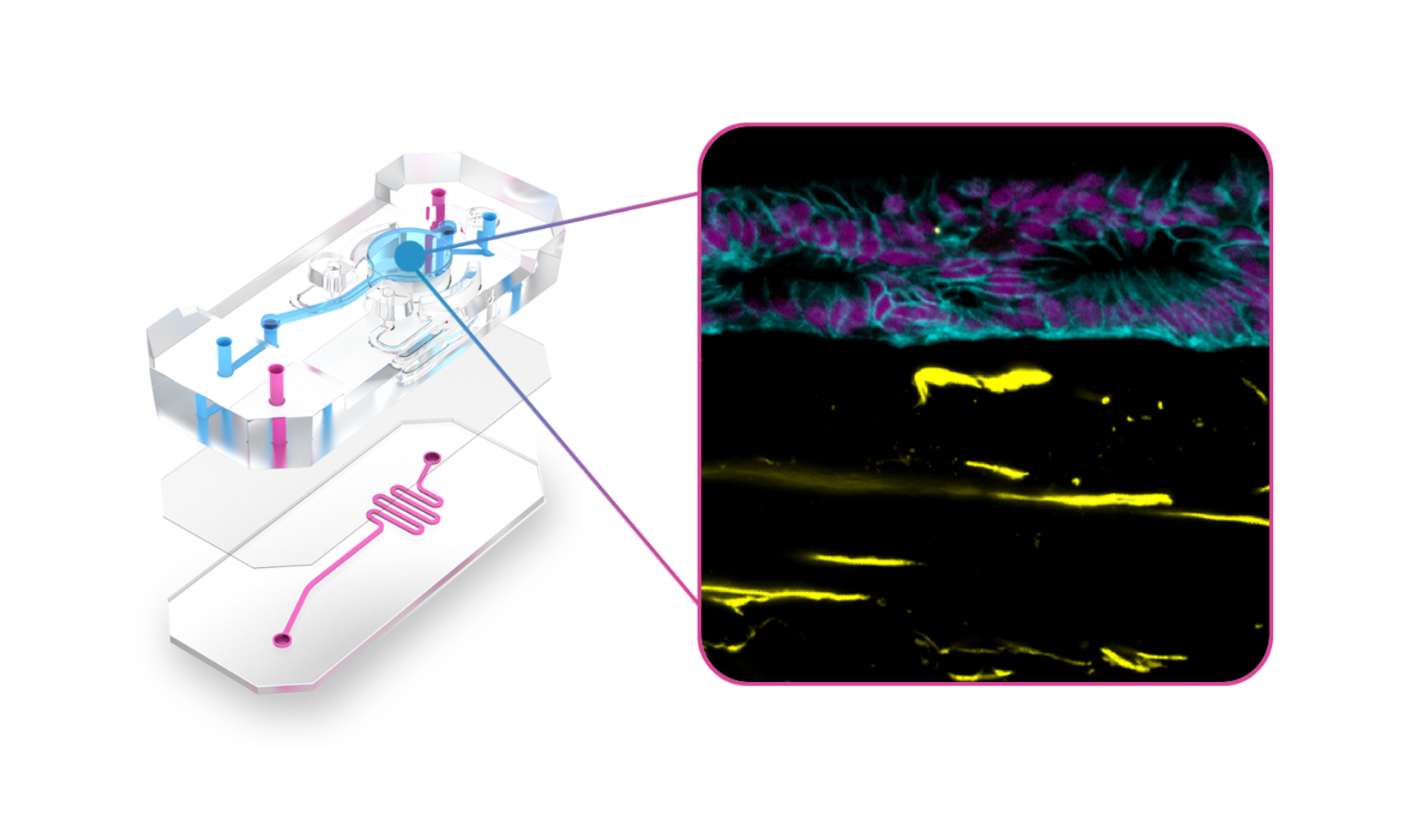 Unraveling the Complexities of Cancer Through More Human-Relevant ...