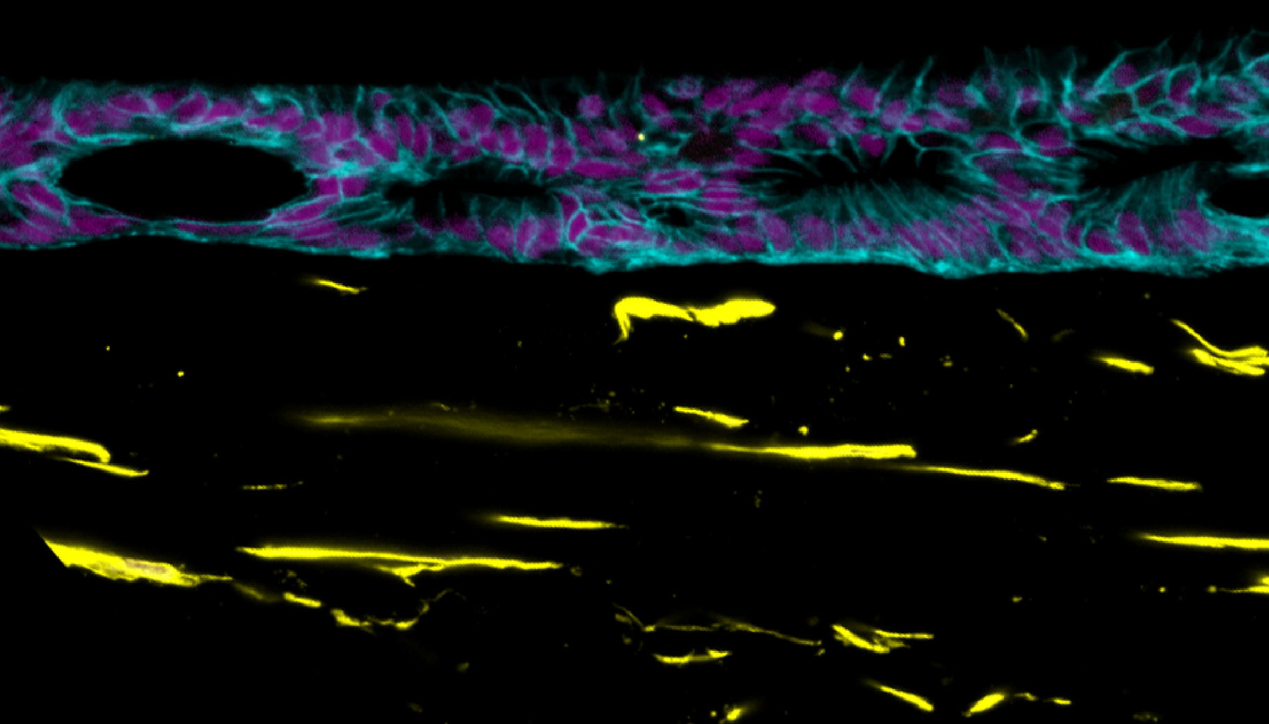 Emulate Chip-A1 Accessible Chip