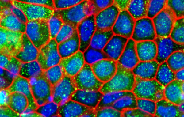 Emulate Chip-A1 Accessible Chip