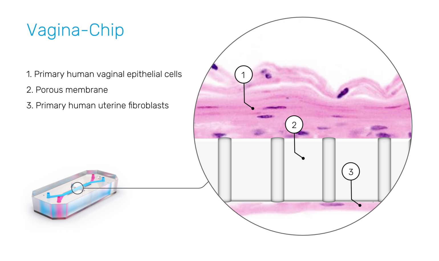 Closing the Gap: How Organ-Chips Are Transforming Women’s Reproductive ...