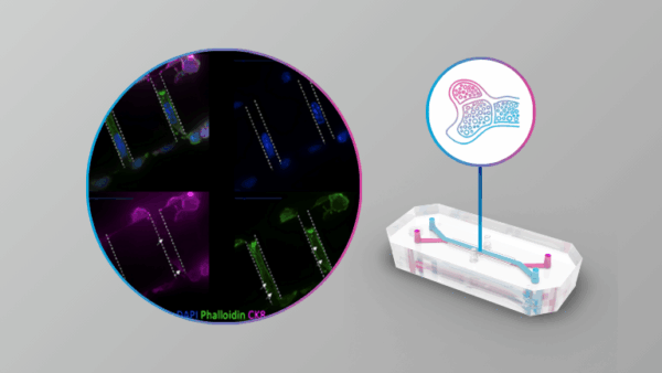 Multi-omics qualification of an organ-on-a-chip model of osteolytic bone metastasis | Emulate